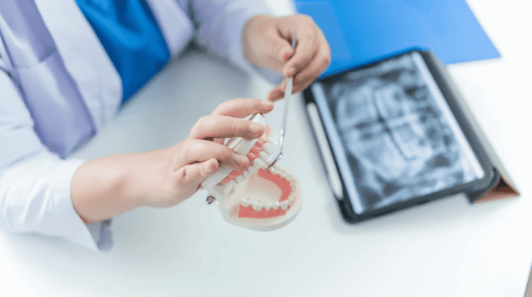 How to Handle Tooth Decay? 5 Stages from Early Symptoms to Severe Tooth ...