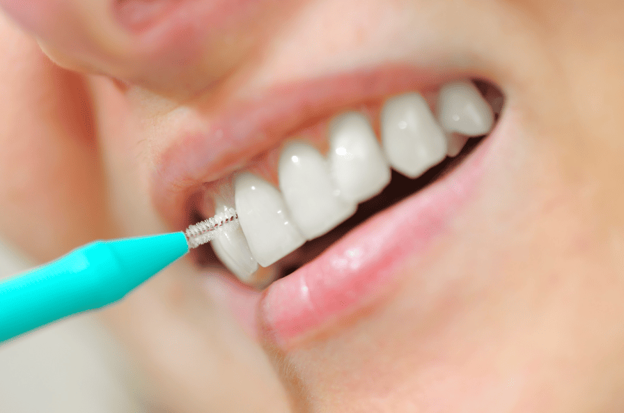 【Interdental Brush Guide】How to Choose and Use It? Who Should Use It ...