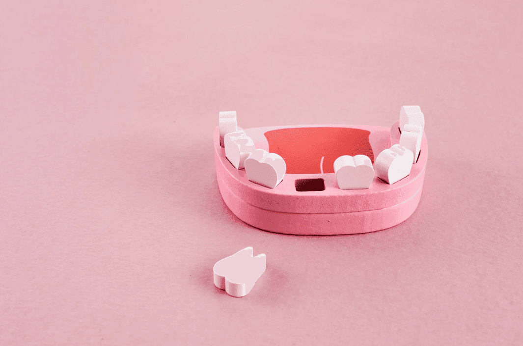 How to Fix Missing Teeth: Causes and Treatments - Smith and Jain Dentists