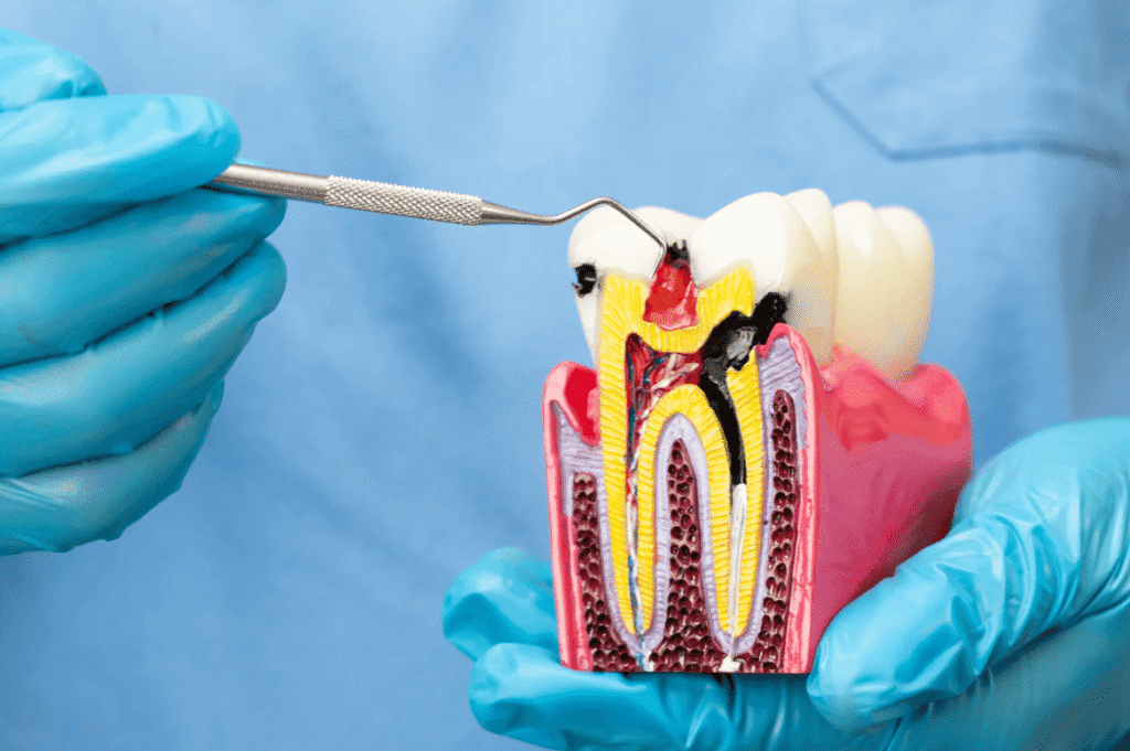 The Hidden Problem: A Guide to Impacted Canine Teeth - Smith and Jain ...